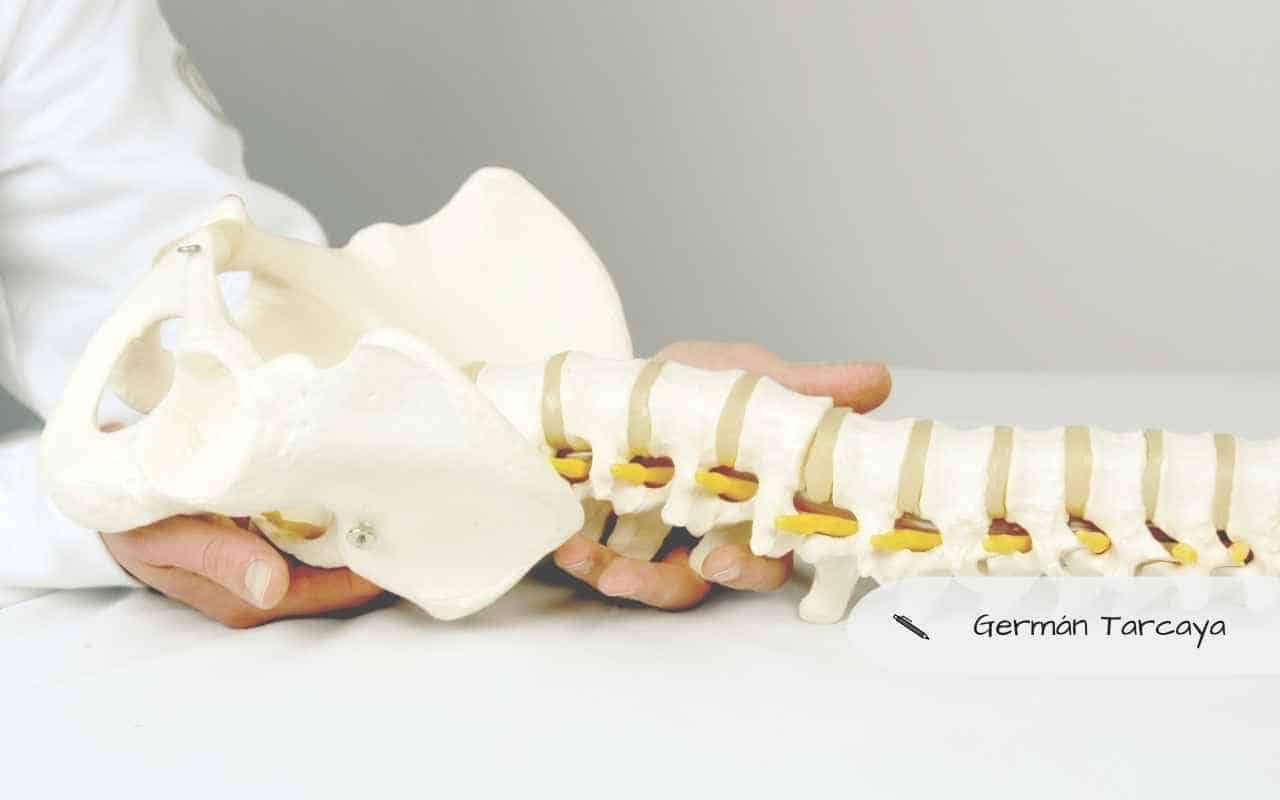 Hernia discal: síntomas, causas y tratamiento - Fisioterapia para ...